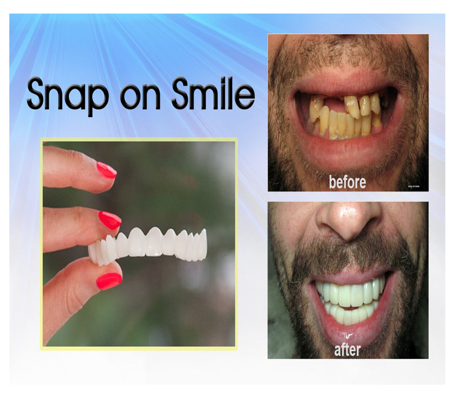 Snap on Smile – Kholood Dental Clinic